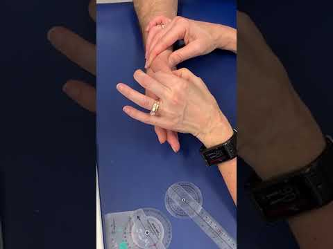 Thumb: MCP flexion ROM
