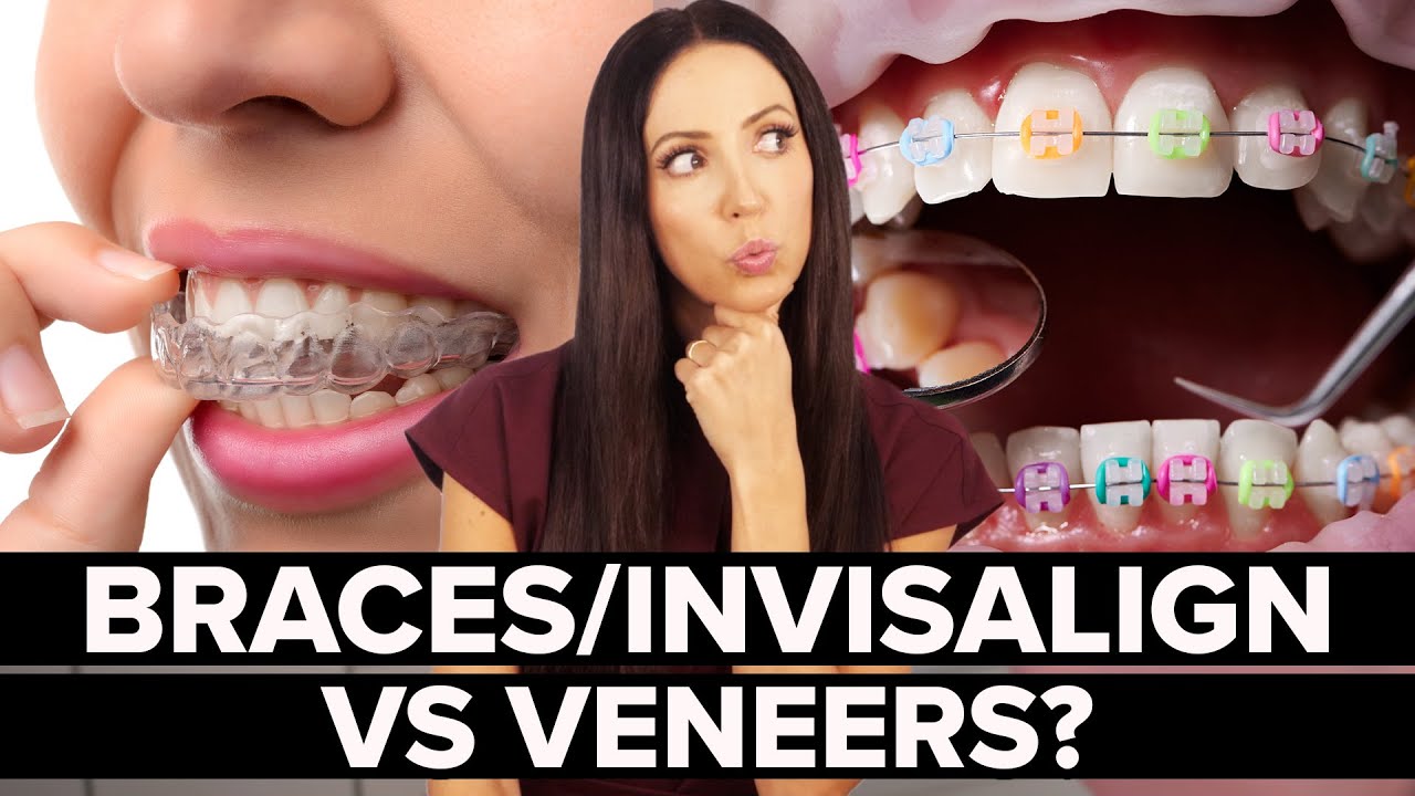 Invisalign vs Veneers: What’s Right for Your Smile?