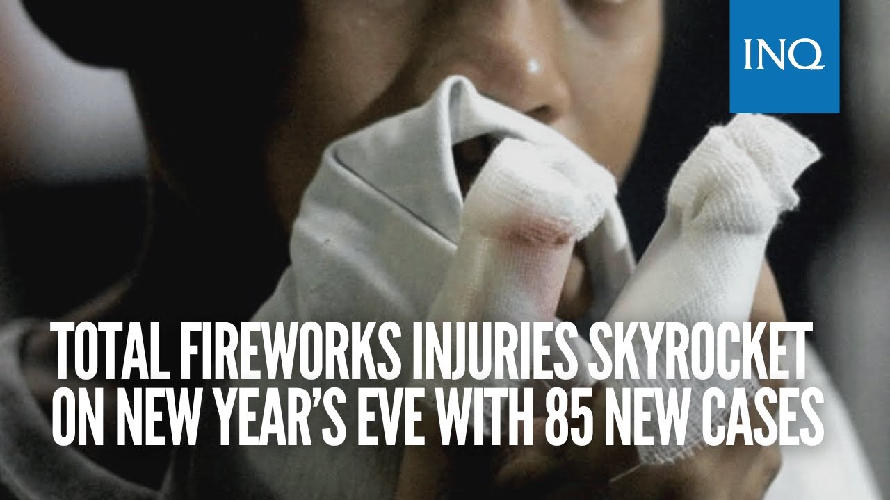 Total fireworks injuries skyrocket on New Year’s Eve with 85 new cases