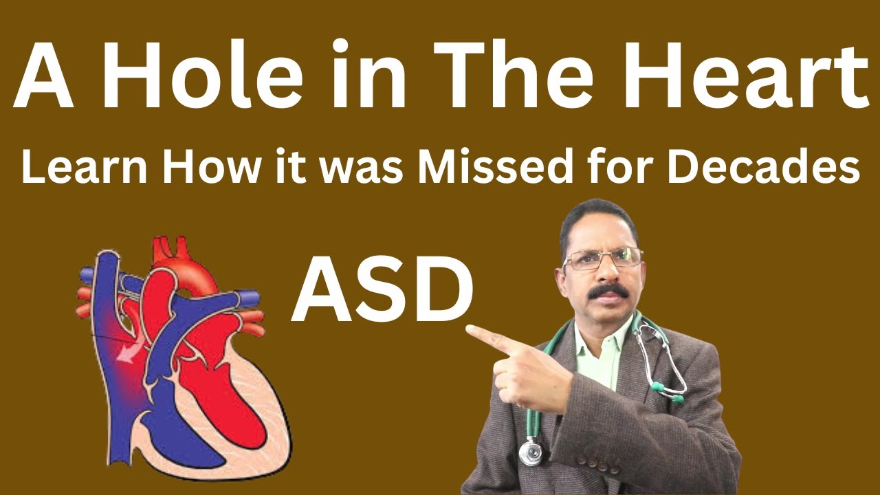 WARNING ! Atrial Septal Defects Can Hide in Plain Sight for DECADES