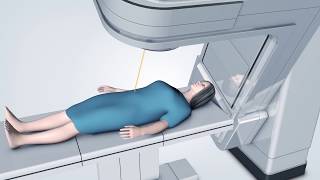 What to Expect of Radiation Therapy | Stanford Health Care