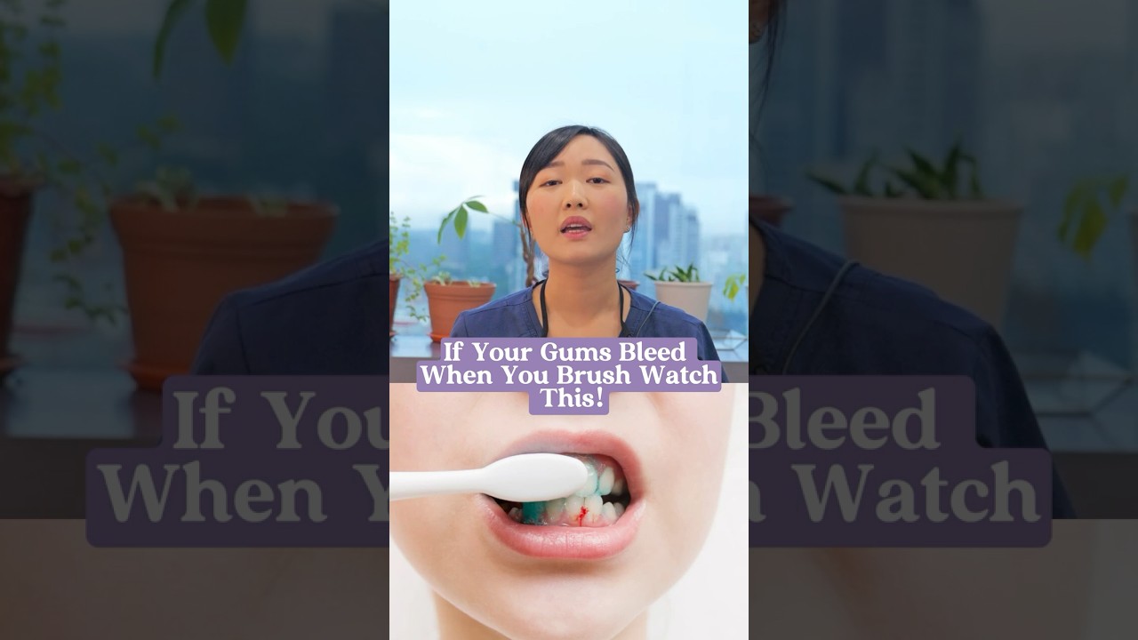 Gums bleeding while brushing? Watch this!