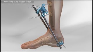 Patient Education in Orthopedic Surgery – OrthoIllustrated