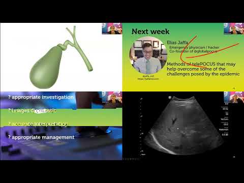 How to: Common Bile Duct Ultrasound - Zedu Coaching Corner - Zedu POCUS Coaching Corner June 4