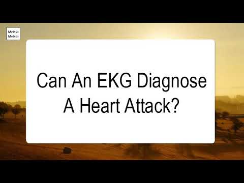 Can An EKG Diagnose A Heart Attack