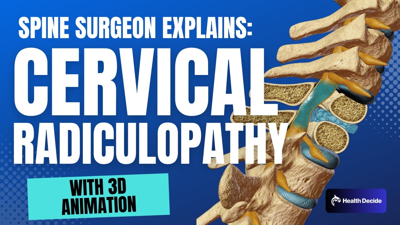 An Orthopedic Surgeon's Guide: Cervical Radiculopathy