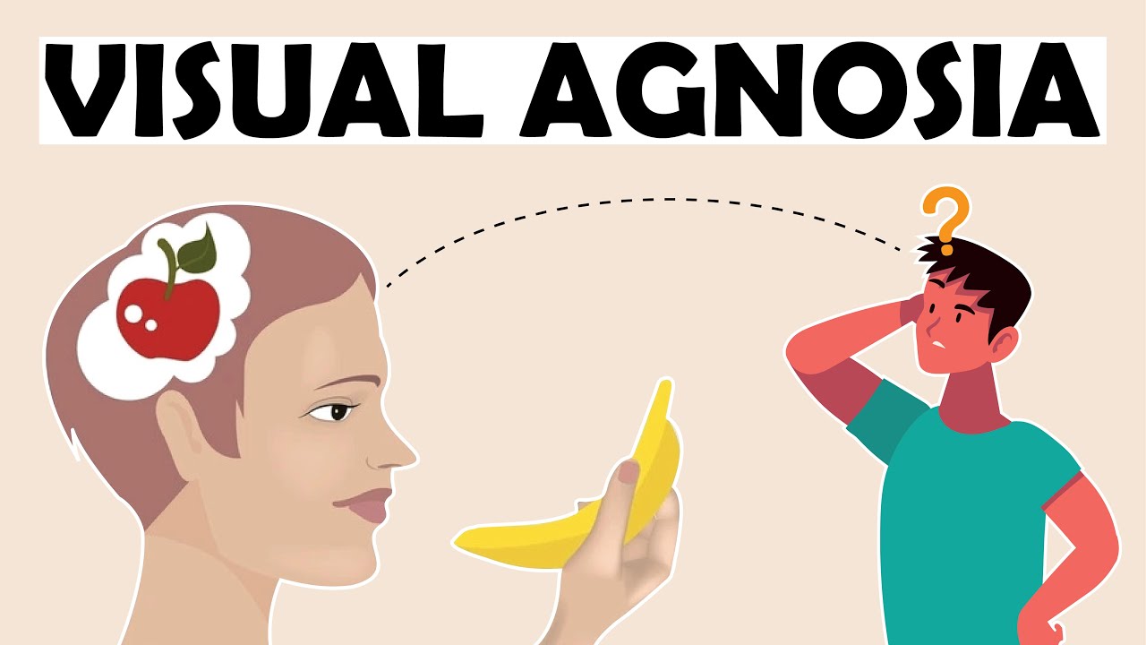 What is Visual Agnosia? 10 Things You Need to Understand