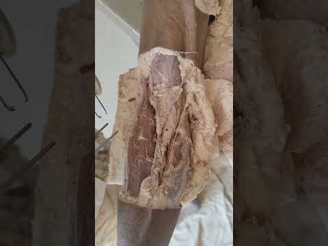 Cubital fossa: a quick view #anatomy #structures