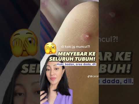 BUKAN JERAWAT tapi TERNYATA… | dr. Clarin Hayes