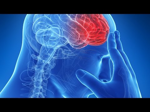 Stroke: Causes, Symptoms and Treatment | Health Matters | KSPS PBS