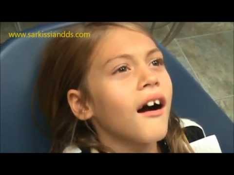 Laser frenectomy on a child by Dr Joseph Sarkissian