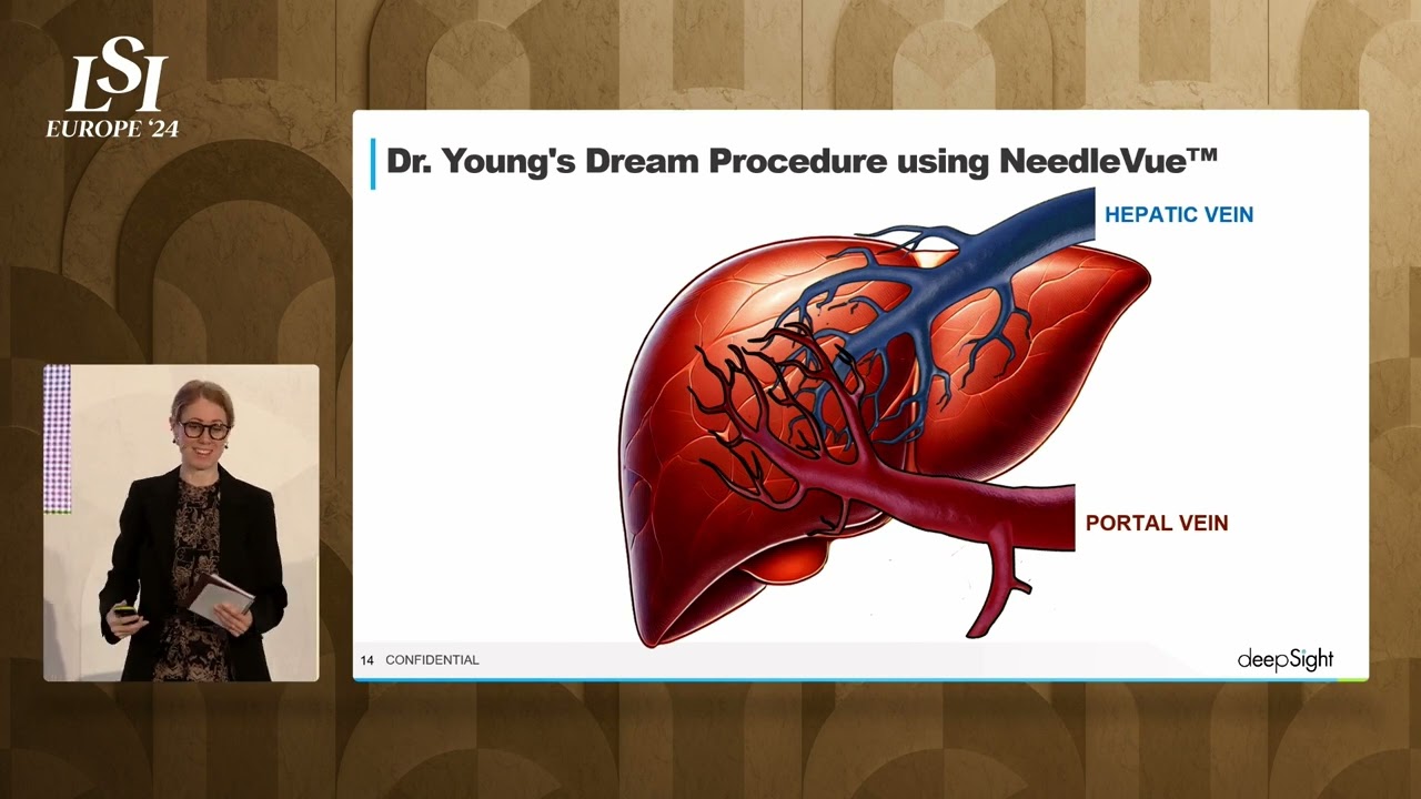 LSI EUROPE24 DeepSight Technology