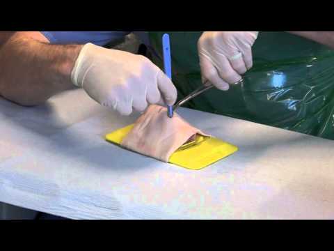 Cricothyroidotomy