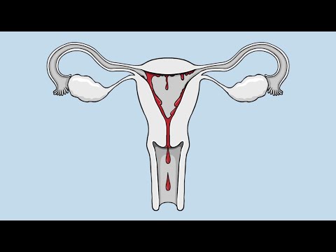 What are periods?