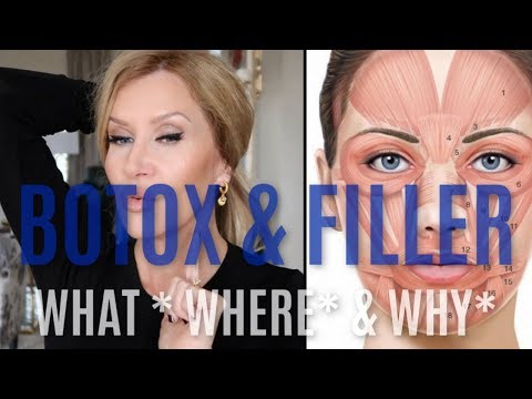 Filler & Botox~What I Have and Why