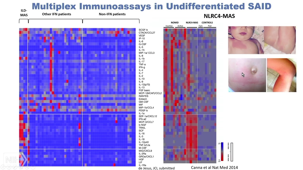 Biomarker Boot Camp: Interferon Activation