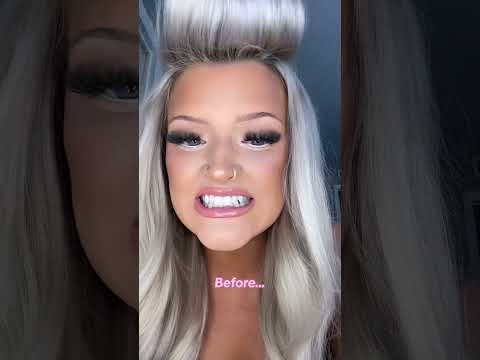 Instant Teeth Whitening Transformation #colorwheelteethwhitener