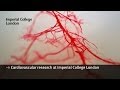 Sian Harding | About | Imperial College London