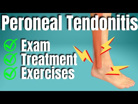 Peroneal Tendonitis Treatment | San Diego Sports Chiropractic