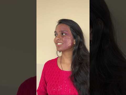 Behind scenes of ACID ATTACK NUKKAD NATAKπ#trending#awareness#explore#acting #drama #college#share