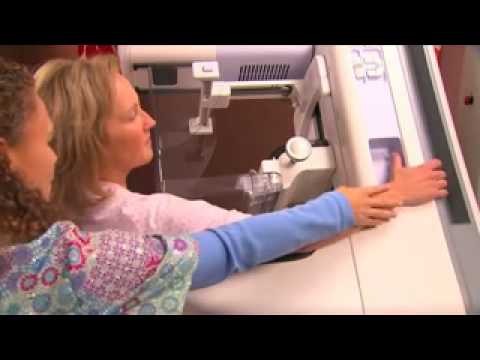 Hologic's 3D mammography system becomes first to get FDA approval xvid