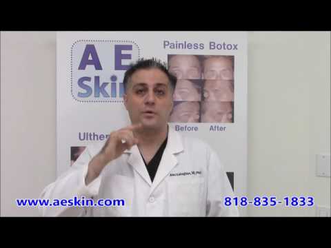 Botox to Elevate the Corners of the Lips - A E Skin - Encino, CA - 818-835-1833