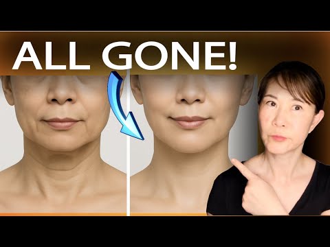 How I Got a More Defined Jawline & Chin at Home FAST! No filters.