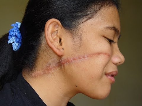 Religious Persecution And Hostility On The Rise In Indonesia