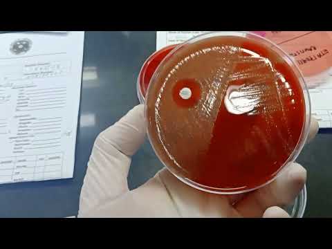 Streptococcus pneumoniae