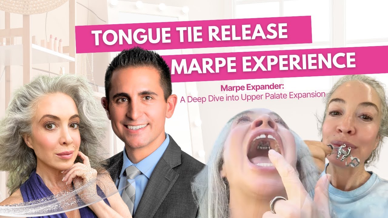 Tongue Tie Release & Marpe experience