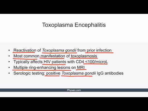 Encephalitis || Inflammation of brain Parenchyma usually of viral etiology(eg, HSV, West Nile virus)