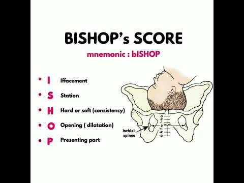BISHOP's score mnemonic #short #shortsvideo