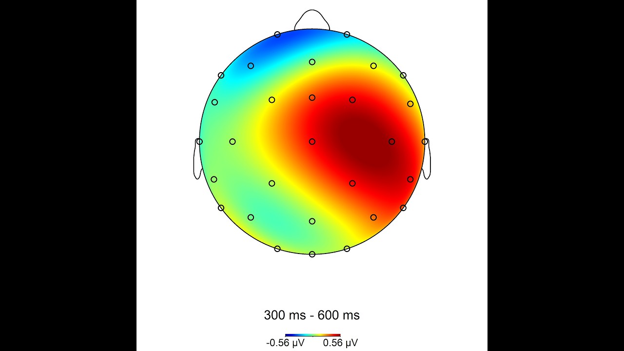 Visualising EEG effects with topographic mapping in BrainVision Analyzer