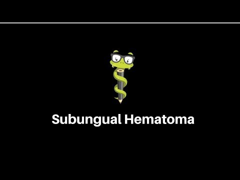 Subungual Hematoma