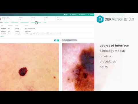 Introducing DermEngine 3.0