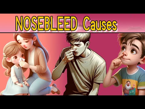 Nosebleeds - Top 7 Causes: When to Worry?!
