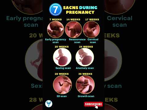 Types of Scans during Pregnancy | Anomaly Scan | 3D scan in Pregnancy #shortsvideo #pregnancy #scans