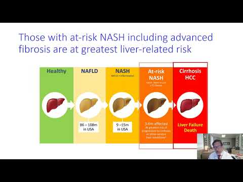 A Proteomics Signature of NASH