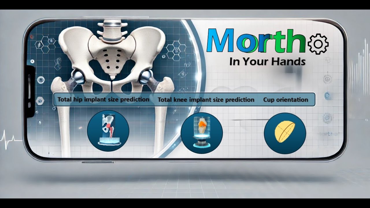 Mortho: Total Hip Arthroplasty Implant Prediction Walkthrough