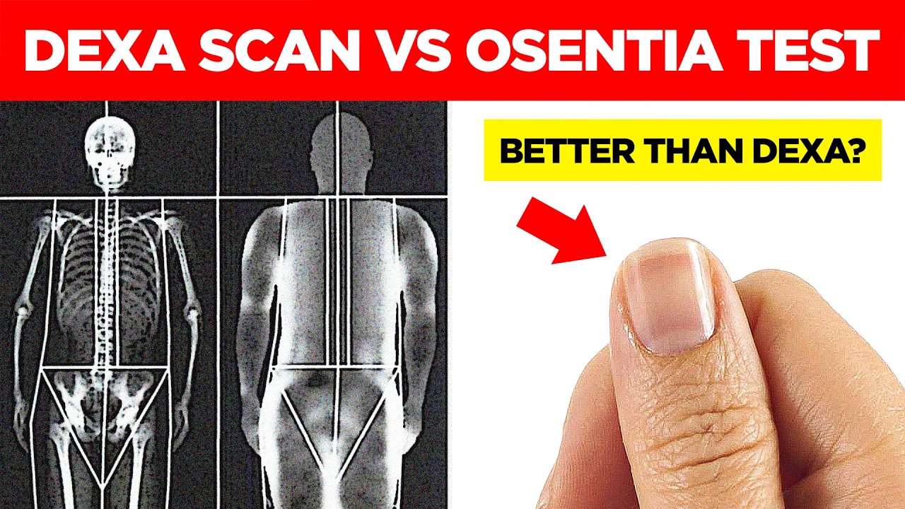 Can This $99 Test Predict Your Osteoporosis Risk? [Doctor Reviews]