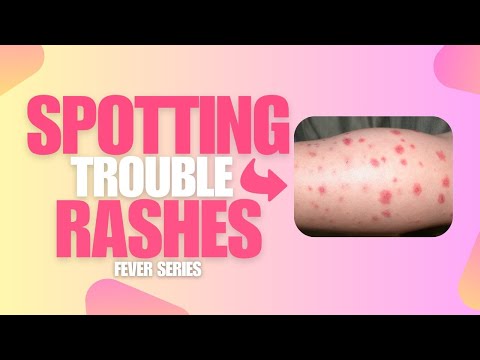 Fever and a Rash in Kids — Red Flags Parents Should Know 🤒