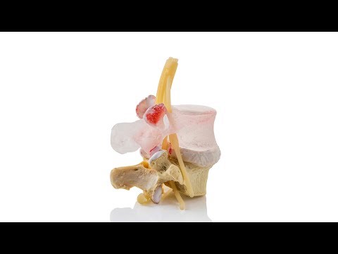 New Professional LxH Dynamic Disc Model - Product Video