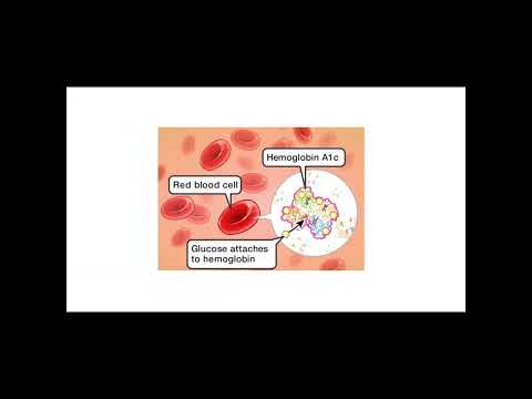 Diabetes Mellitus: Complications and Diagnosis | Diabetes Type 1 , Diabetes Type 2 | Part 3