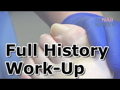 Full History Work-up.  Diabetes, Neuropathy and Brain Illness. FEET-ure Friday (2022)