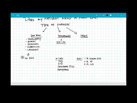Preop EKG