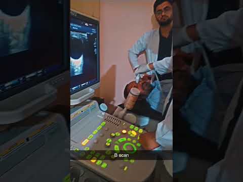 #EYE ULTRASOUND (B SCAN)#youtubeshorts#viralshortsvideo#viralviews