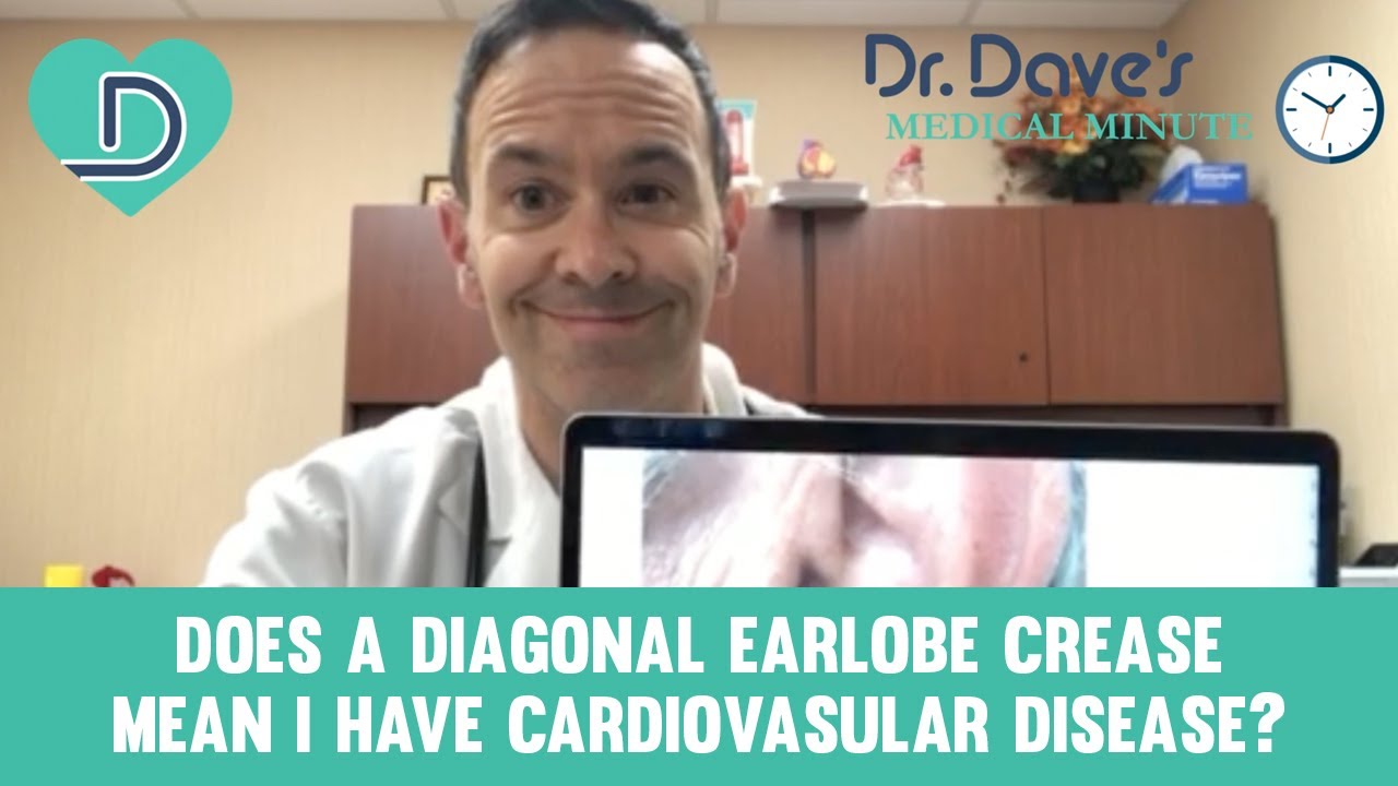 Does a Diagonal Earlobe Crease Mean I have Cardiovascular Disease?
