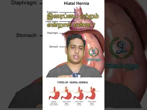 இரைப்பை ஏற்றம் என்றால் என்ன|Hiatal Hernia Tamil|Hiatal Hernia symptoms #hiatalhernia #gerd #ulcer