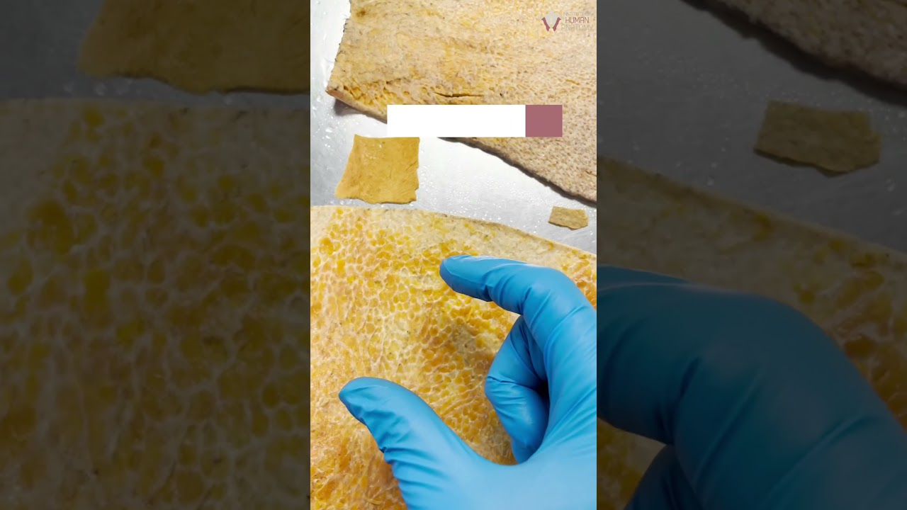 Showing How Thick REAL Human Skin Is