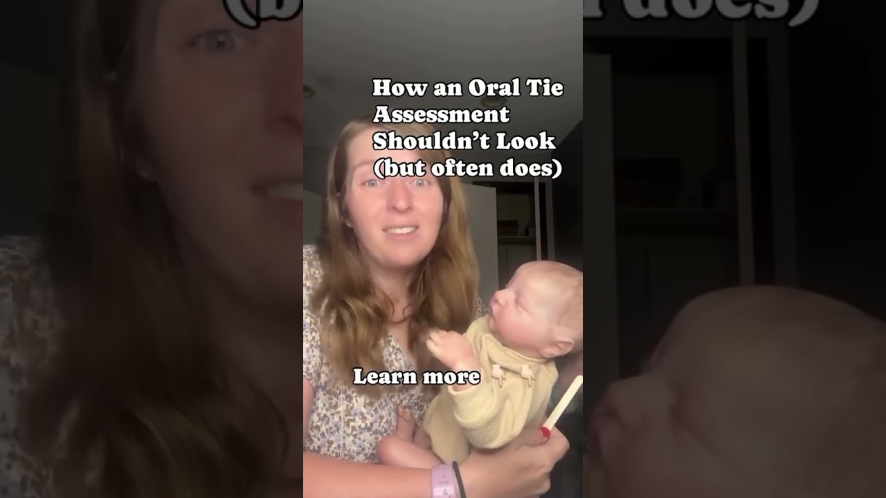 How a Tongue Tie Assessment Shouldn’t Look #breastfeeding #tonguetie